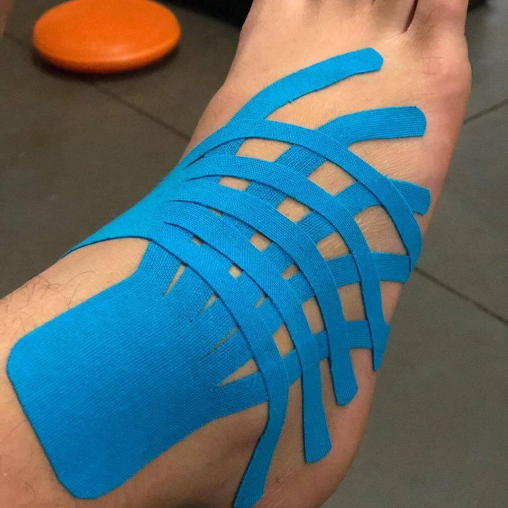 Kinesio Tape Edema Foot at Kayla Clubbe blog